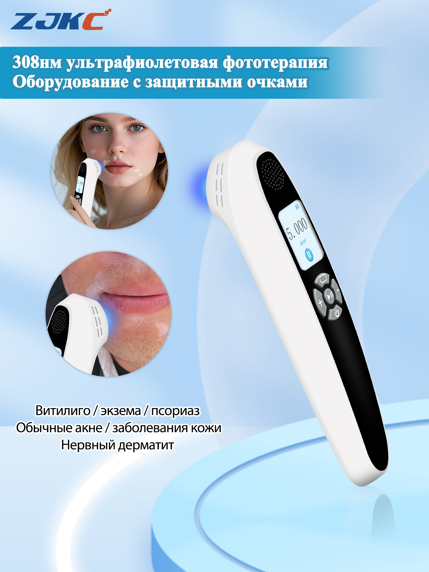 Лампа UVB для фототерапии 308 нм способствует восстановлению кожи при заболеваниях кожи лица и ног