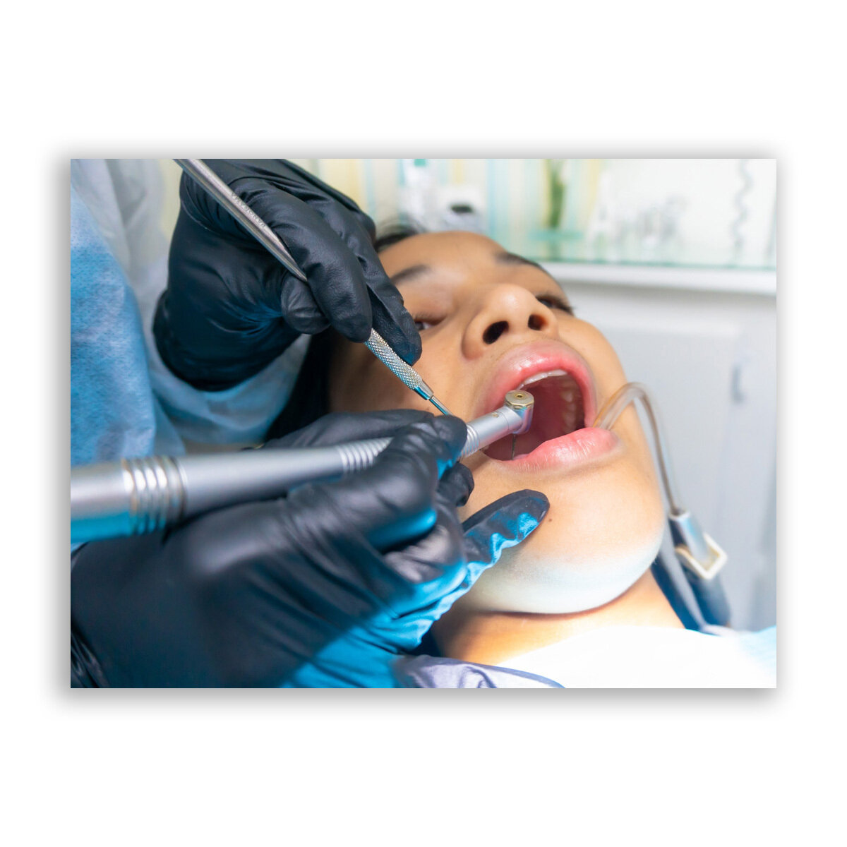 Постер, плакат на бумаге / Для стоматологии / Размер 30 x 40 см