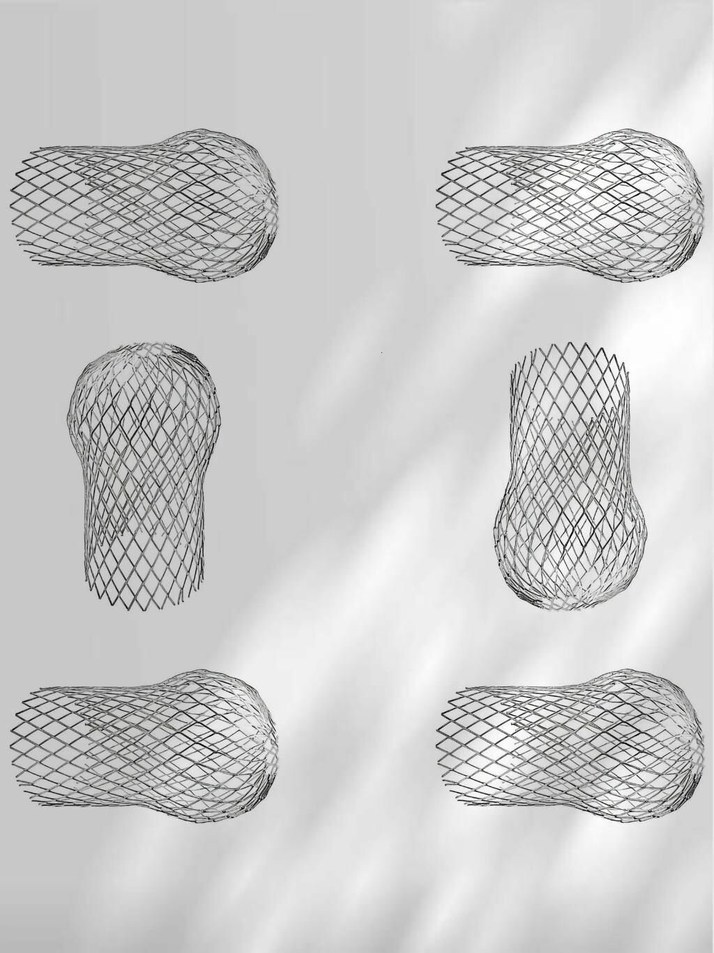 Сетка для водосточной трубы алюминиевая регулируемая