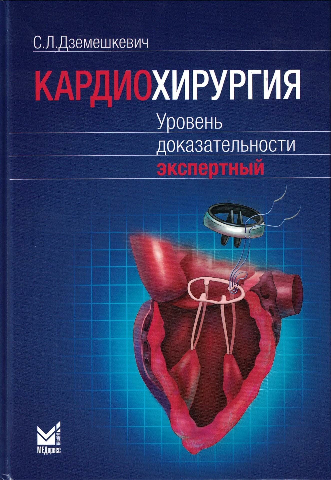 Кардиохирургия. Уровень доказательности экспертный