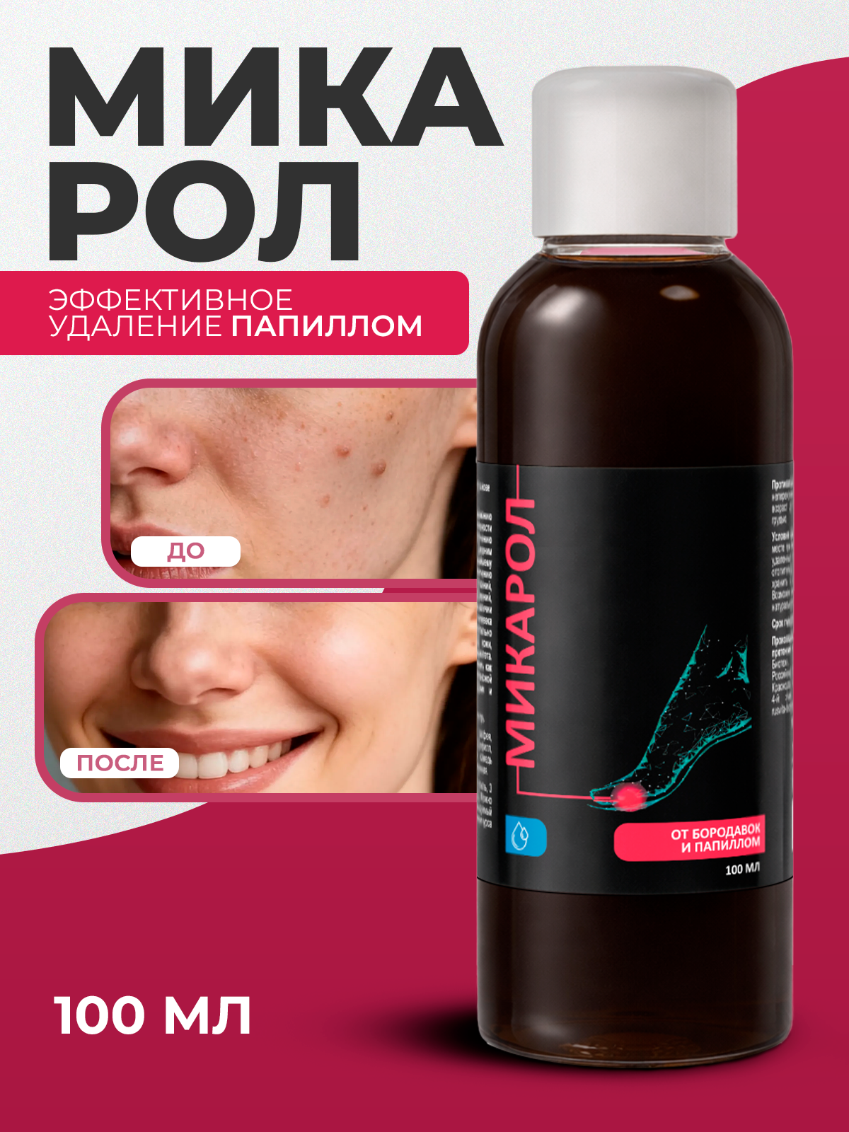 Микалор комплексное решение для борьбы с папилломами, натуральный состав, 60 капсул