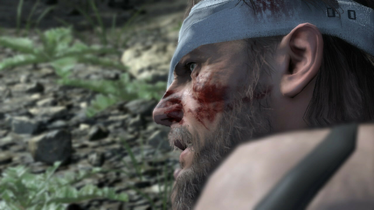 METAL GEAR SOLID V: The Definitive Experience, Все страны — фото 1