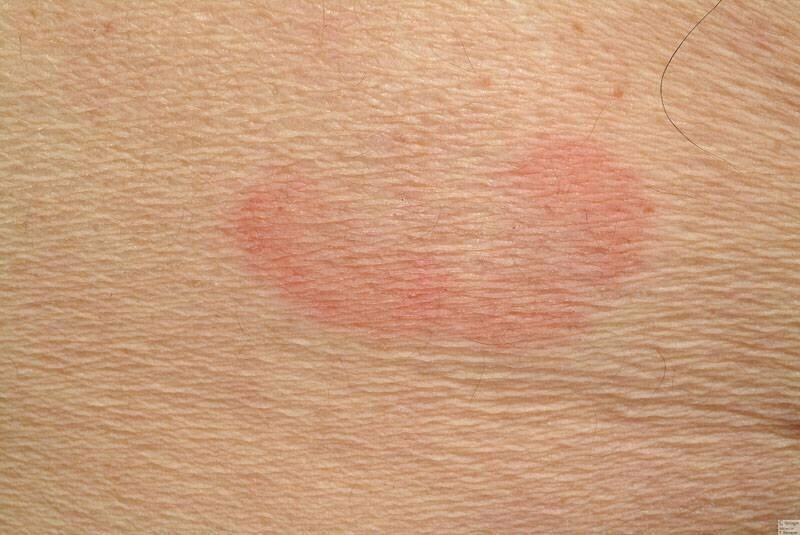 Мазь Цикун Баксиан QICUN BAXIAN от псориаза, экземы, дерматита, зуда, потницы - День Ночь (Ба сянь)