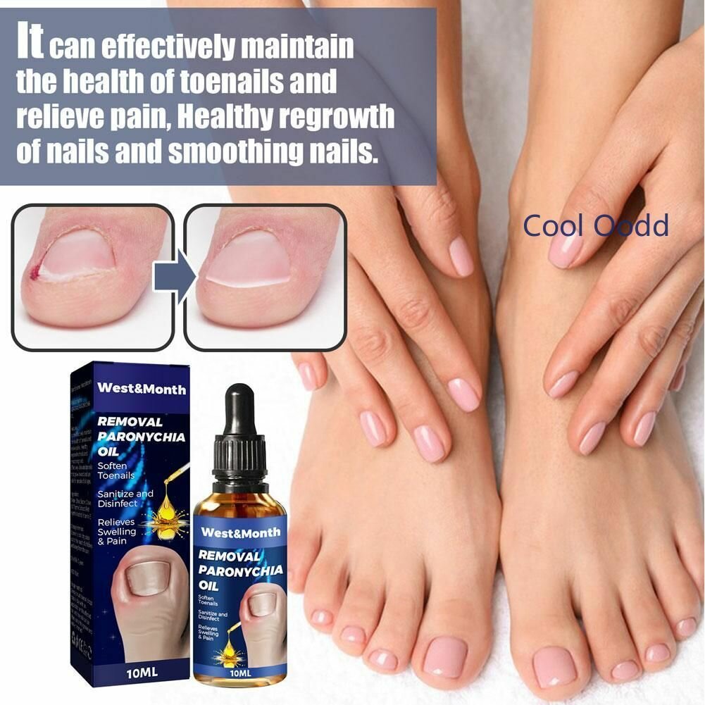 20г Вросшие ногти на ногах, для ухода за ногтями на ногах, удаляется масло паронихии