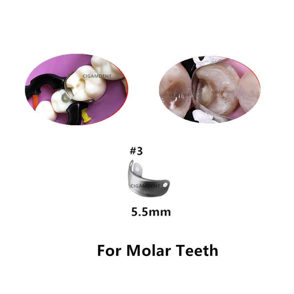 Стоматологические матричные полосы CIGAMDENT для Palodent V3 100Pc 5.5mm Matrix