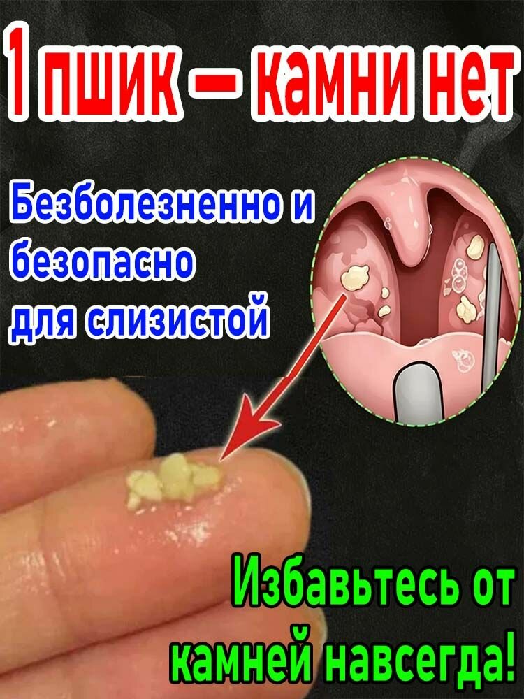 Прибор и спрей для очистки миндалин от пробок