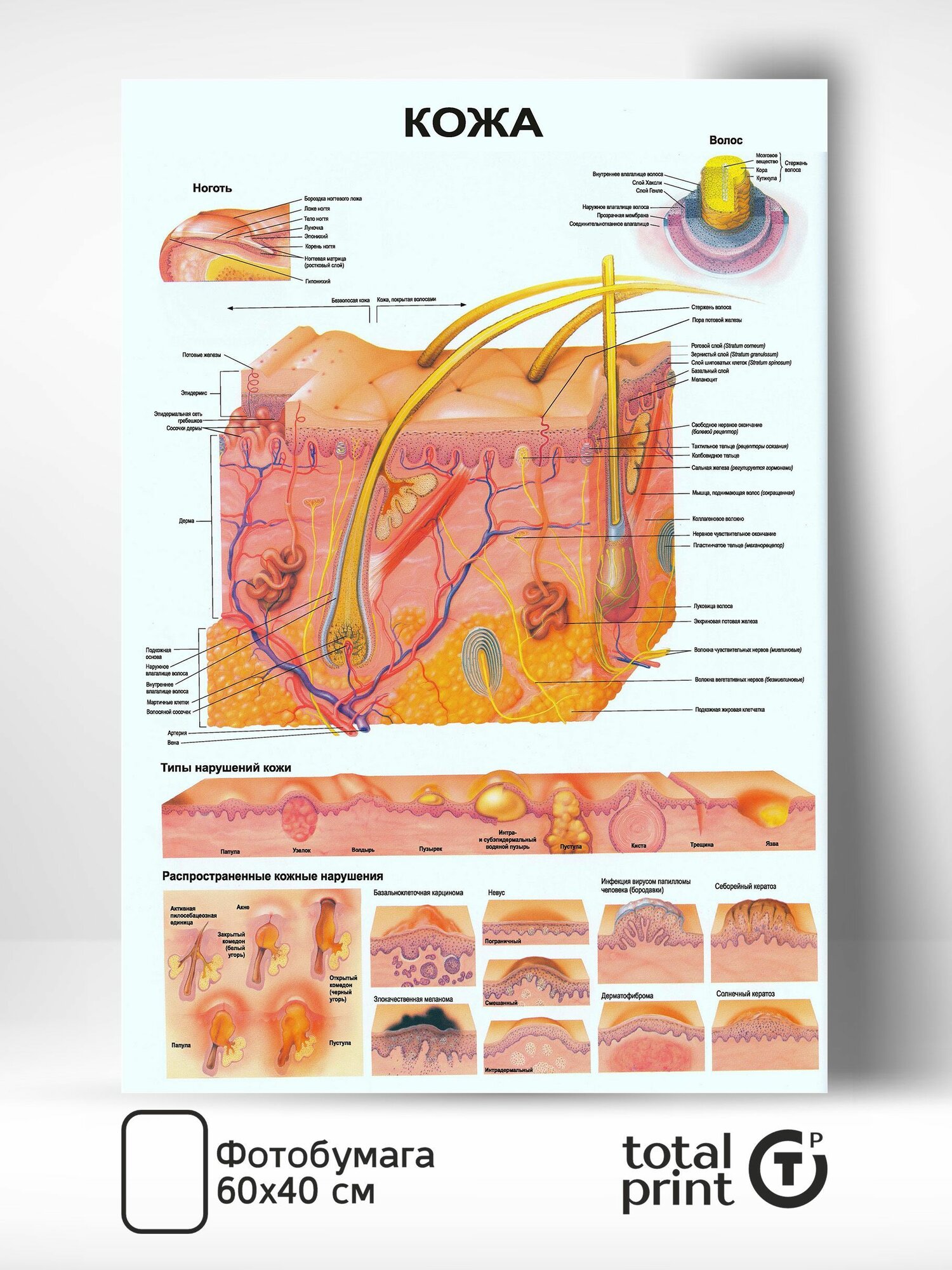 Постер на медицинскую тематику, 60х40см, Кожа, TotalPrint