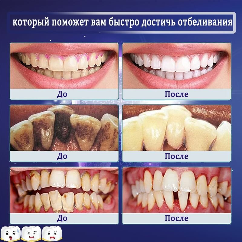 Отбеливающий Карандаш для Зубов/быстрое удаление пятен, не повреждает эмаль, удобно носить/Для чувствительных зубов и быстрого отбеливания