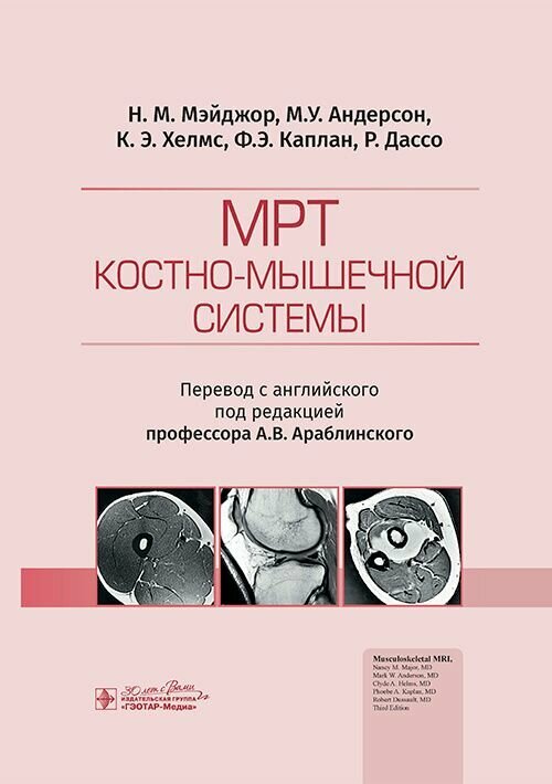 МРТ костно-мышечной системы