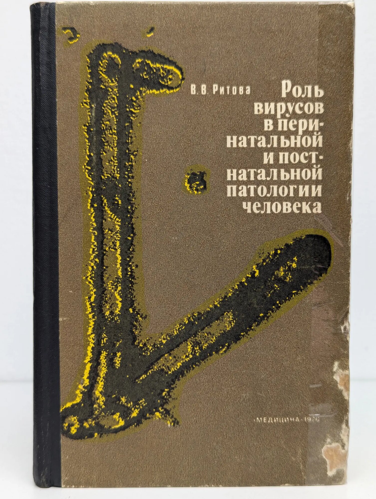 Роль вирусов в перинатальной и постнатальной патологии человека Ритова Валентина Васильевна 1976