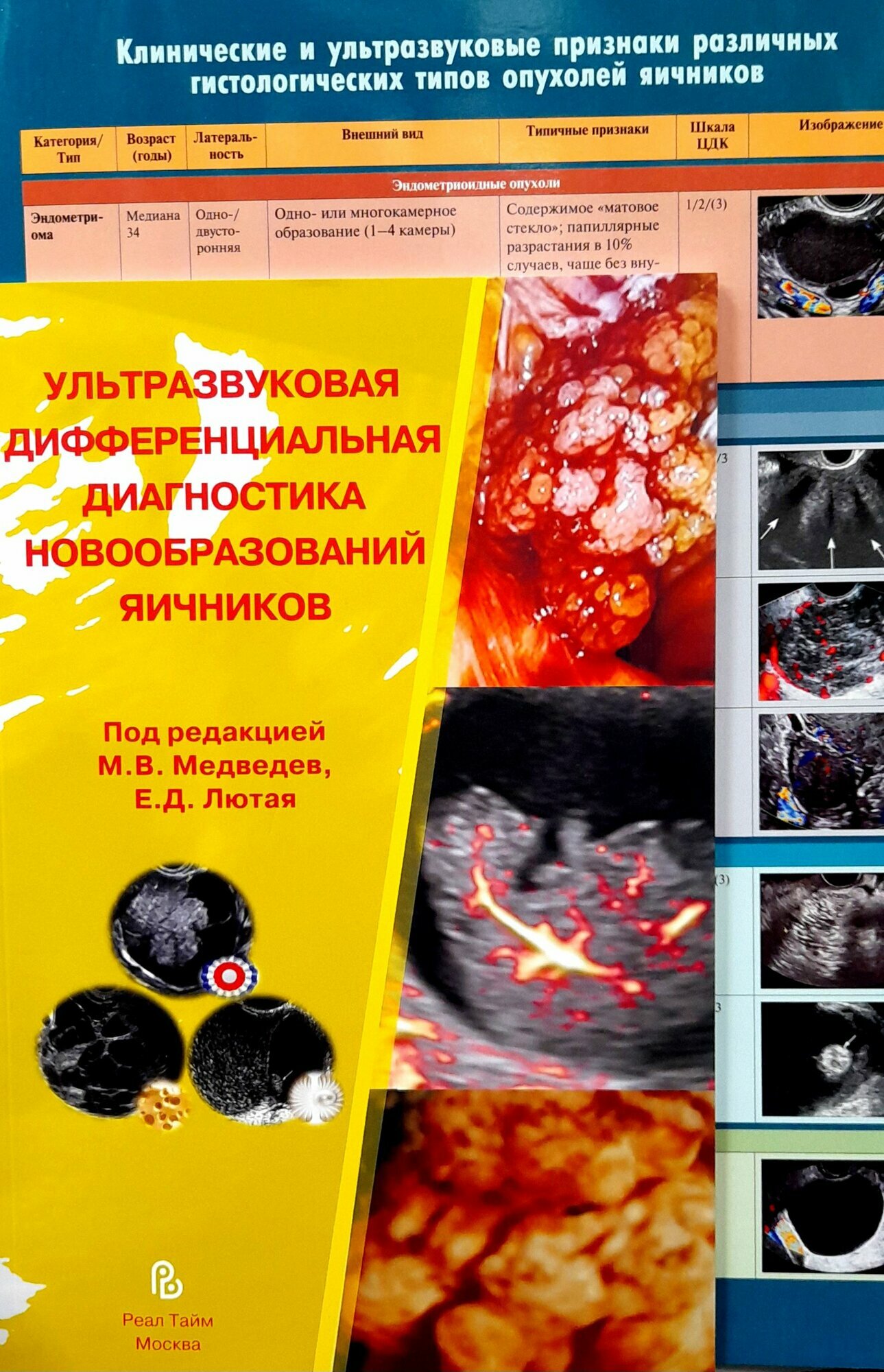 Ультразвуковая дифференциальная диагностика новообразований яичников. Медведев.