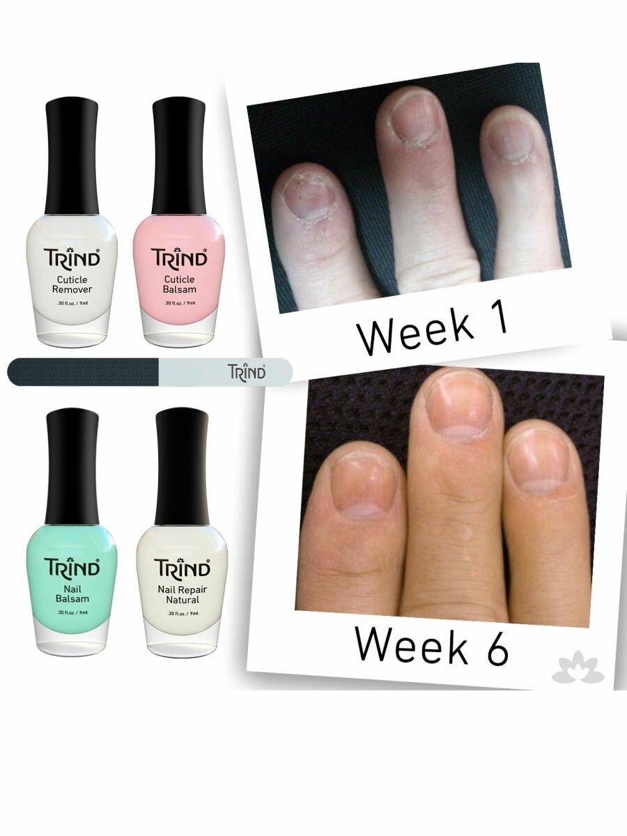 Trind Base Coat Основа под лак 9 мл — фото 1