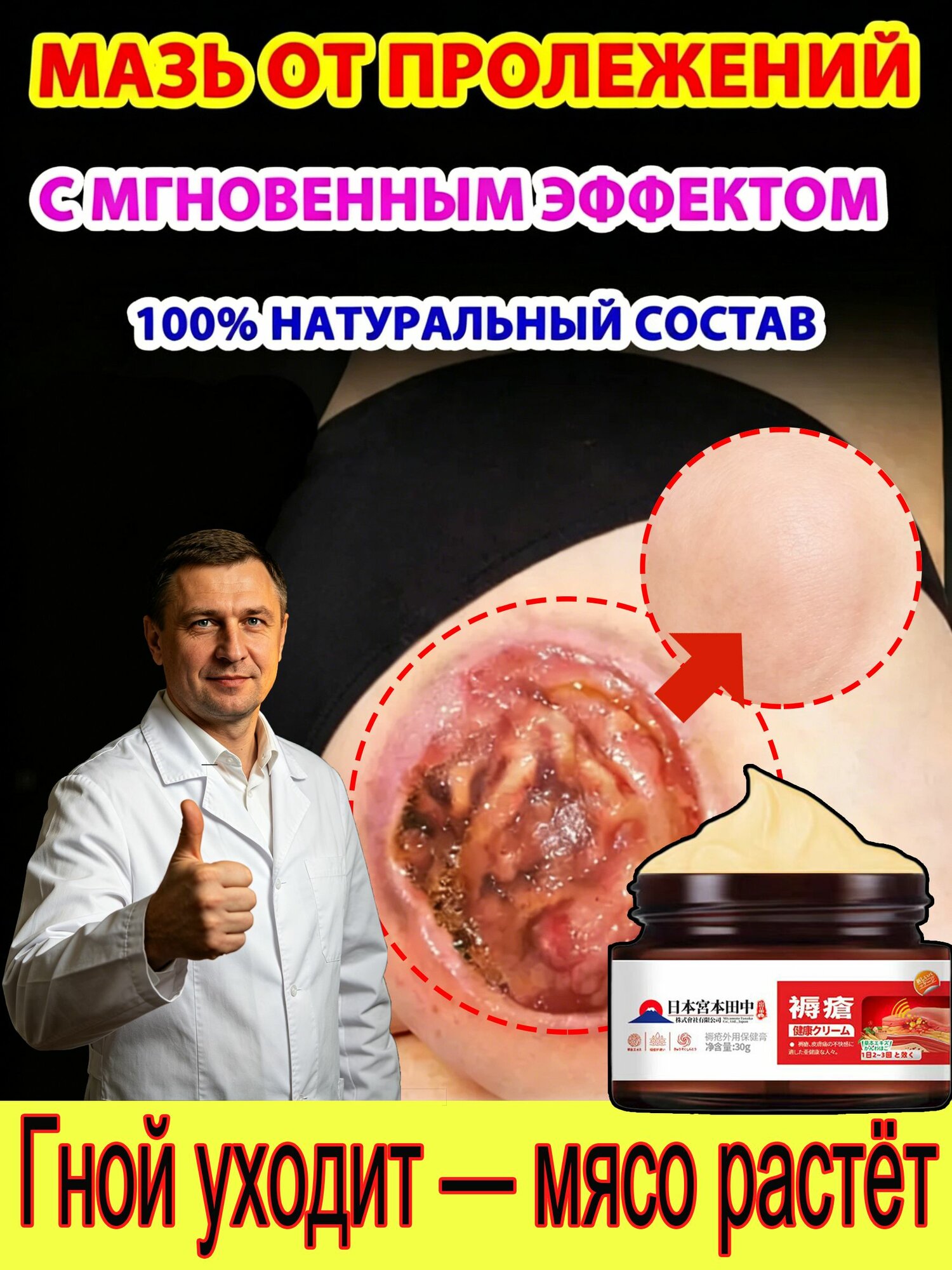 Крем для тела от пролежней, эффективное средство для лечения ран, ожогов и трофических язв 30г