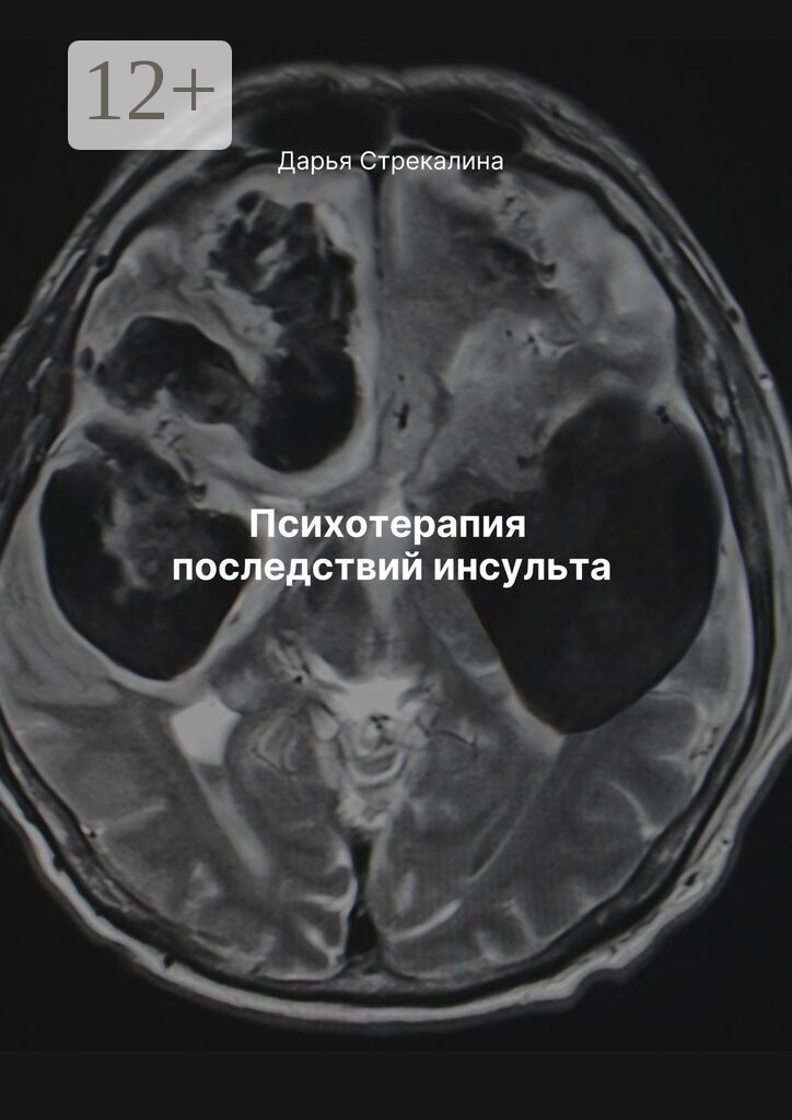 Психотерапия последствий инсульта