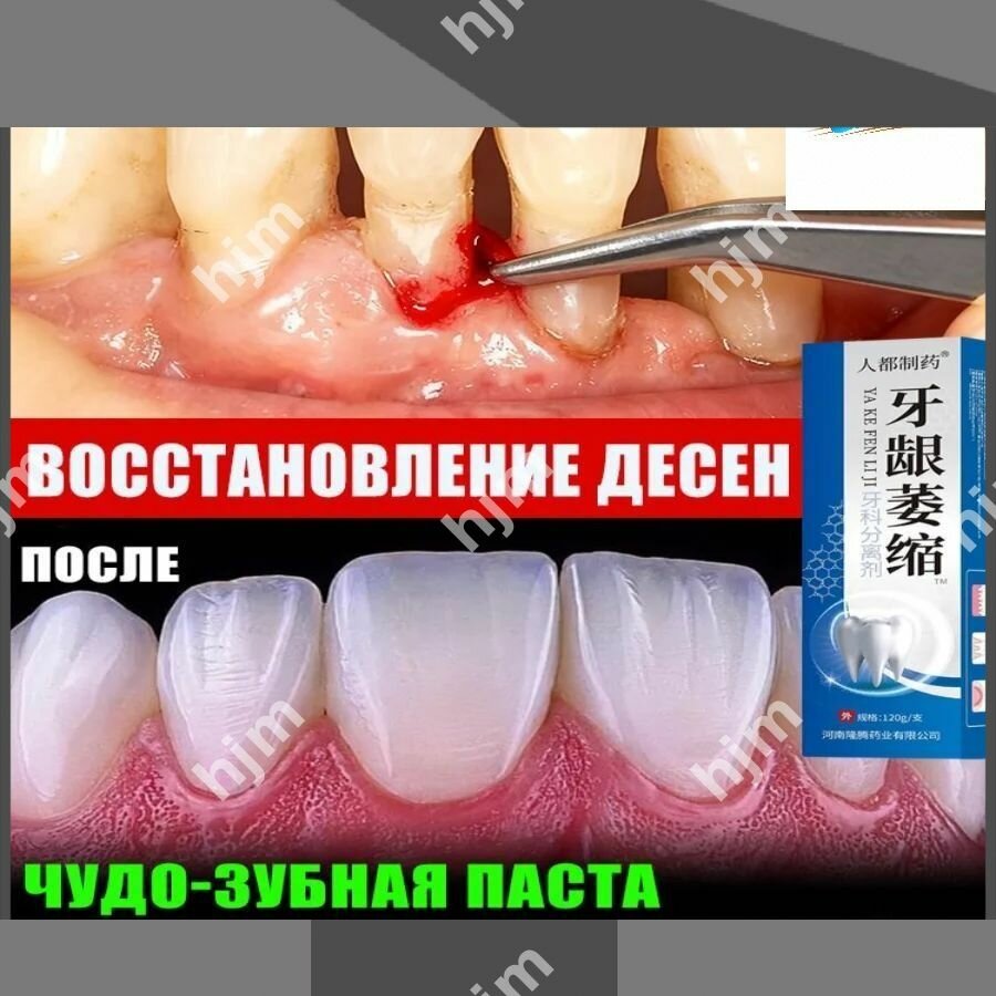 Эксклюзивный бальзам 120г для интенсивного ухода при атрофии и чувствительности десен, стоматите, обеспечивающий антибактериальную защиту полости рта