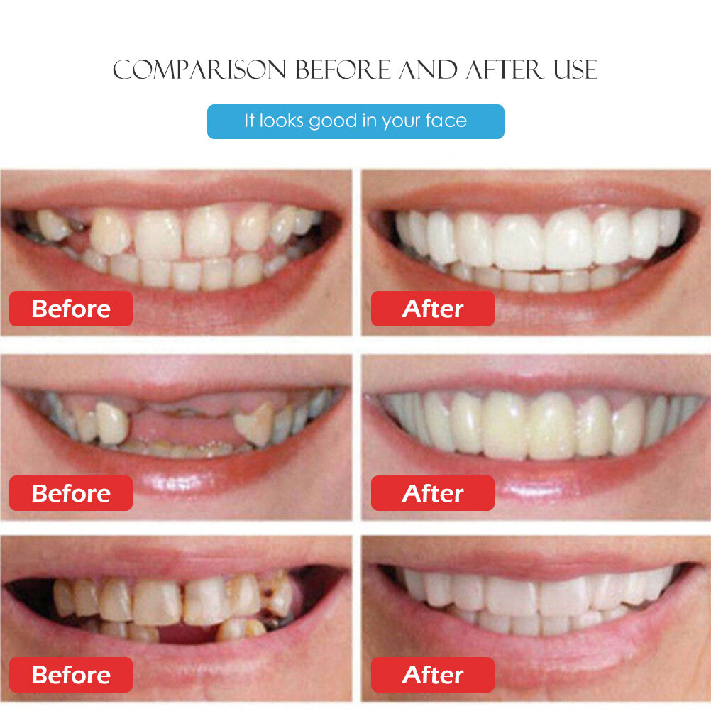 Силиконовые виниры для имитации зубов, гибкие зубные протезы, косметические накладки на зубы, отбеливающие брекеты.
