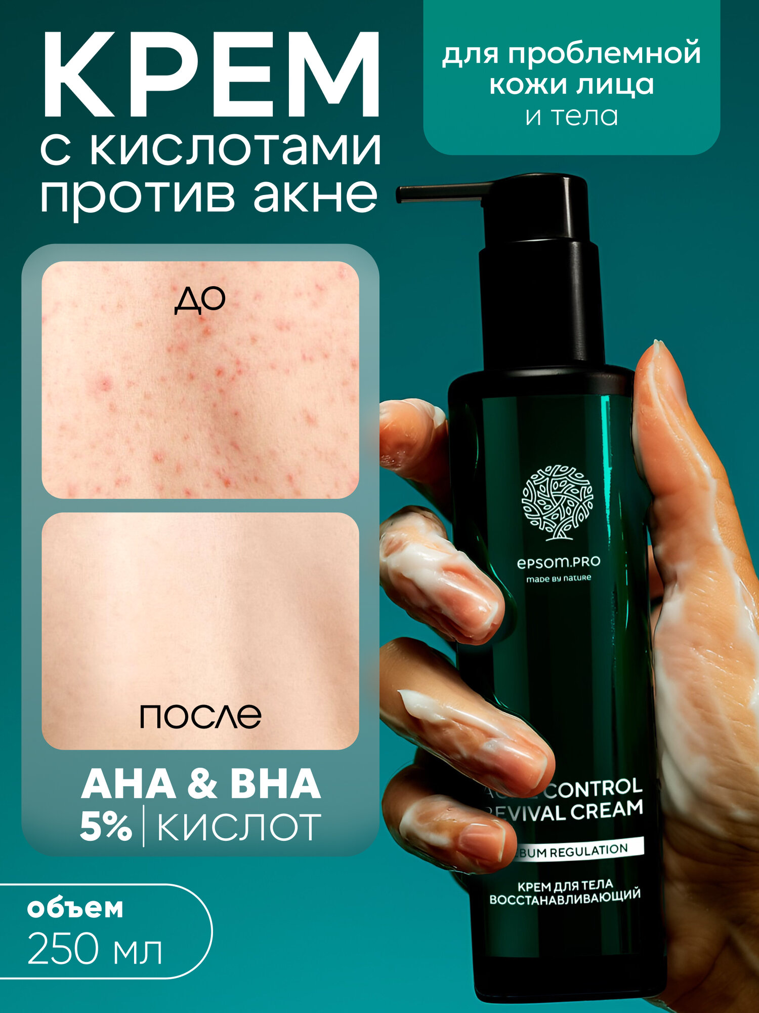 Крем ACNE CONTROL против акне и прыщей 250 мл с AHA и BHA кислотами