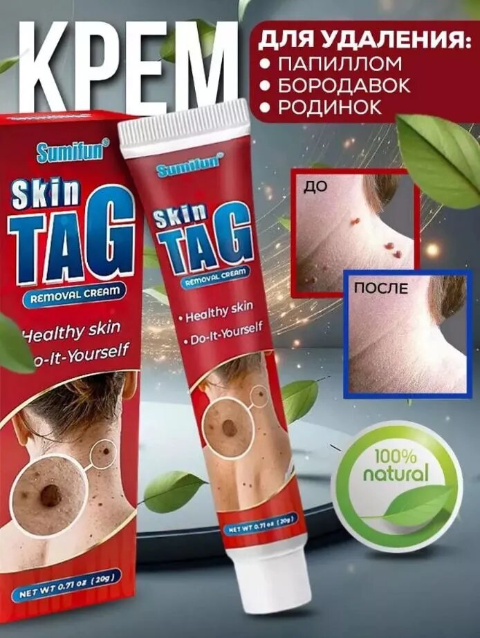 Антибактериальный крем для кожи, способ лечения бородавок и папиллом (крем-гель)