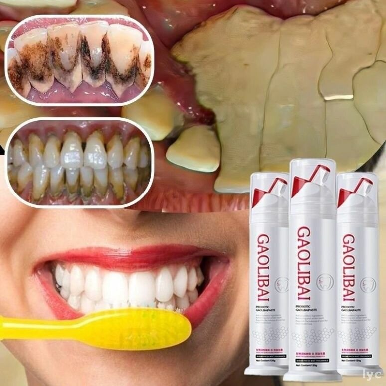 Эксклюзивная черная паста GAOLIBAI 120 г для осветления эмали, эффективно удаляющая налет от кофе, чая, табака и зубного камня, без фтора и парабенов