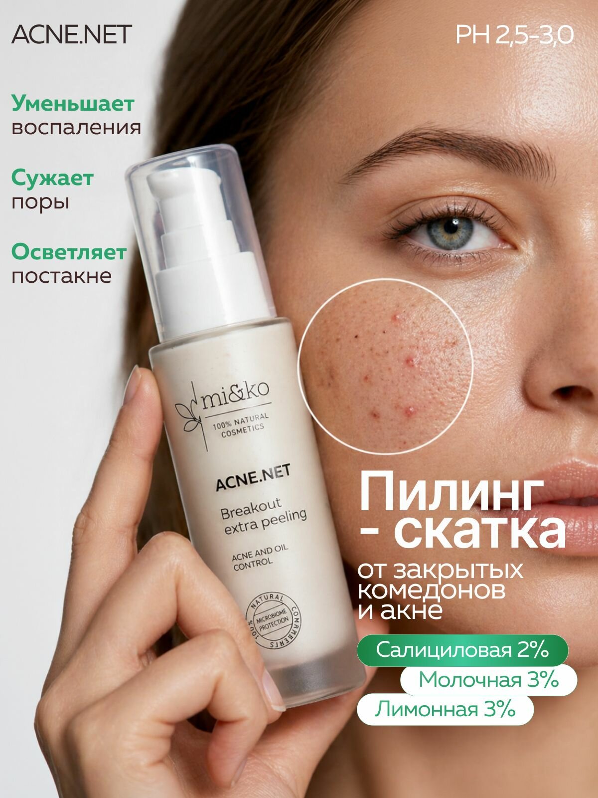 Пилинг-скатка от акне для жирной кожи, для проблемной кожи, от угрей, от прыщей, от постакне Acne net 5% азелаиновая кислота Miko 50 мл