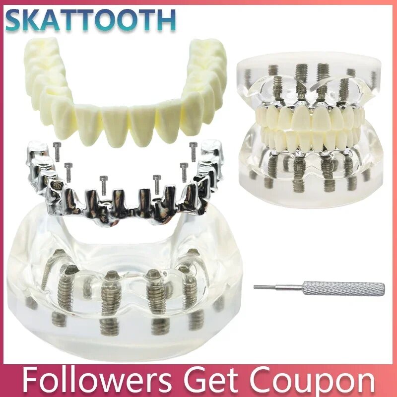 Стоматологическая модель имплантов SKATTOOTH Dental Implant Model — фото 1
