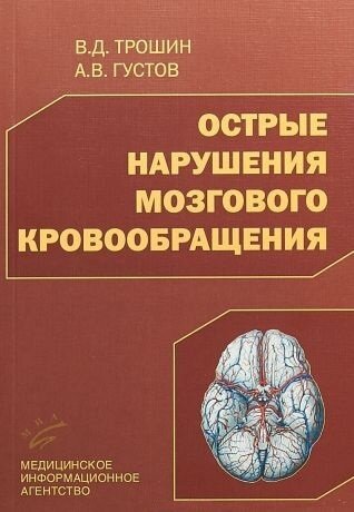 Острые нарушения мозгового кровообращения