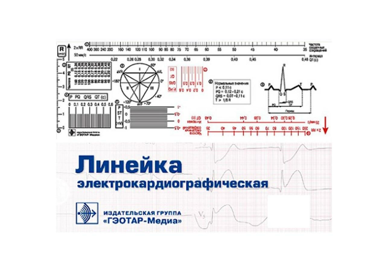 Линейка электрокардиографическая: ЭКГ-линейка для расшифровки электрокардиограммы, снятой со скоростью 50 или 25 мм/с. Гэотар-медиа