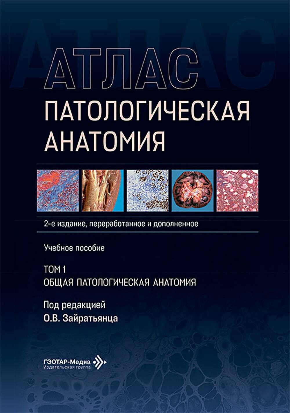 Патологическая анатомия. Атлас. В 2 т. Т. 1: Общая патологическая анатомия: Учебное пособие. 2-е изд, перераб. и доп. Под ред. Зайратьянца О. В.