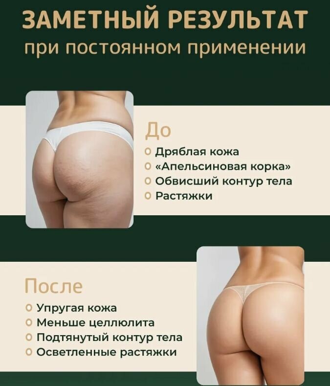 Щетка для сухого массажа/ натуральная/ массажная деревянная щетка 2в1 от целлюлита и растяжек для тела, ног, рук