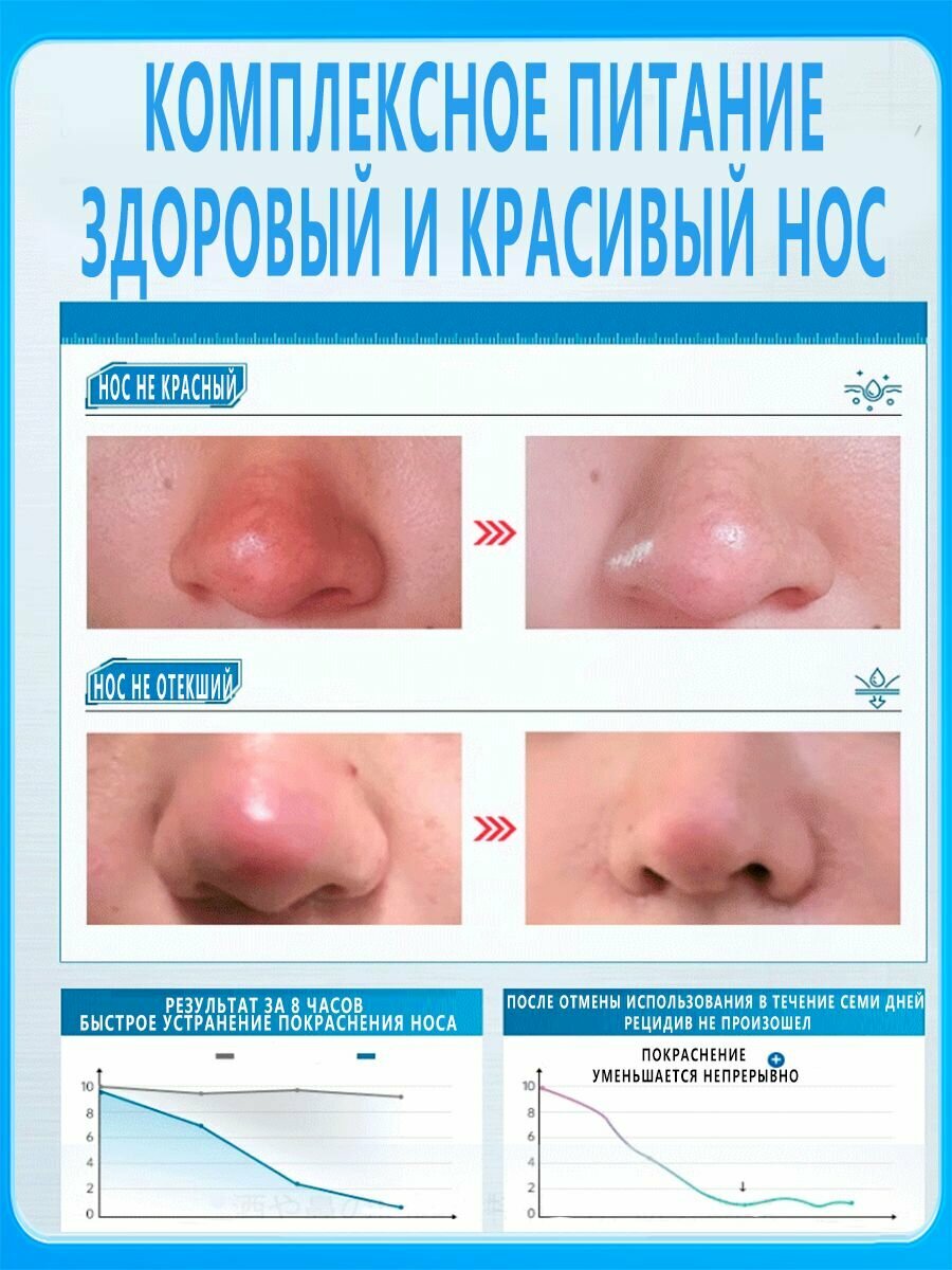 Винная мазь для носа отрозацея и купероза, крем для личения розацеа кожи лица, мазь сосуды носа, Гельтек Гель Демотен Форте от прыщ, крем регенерирующий, 20г