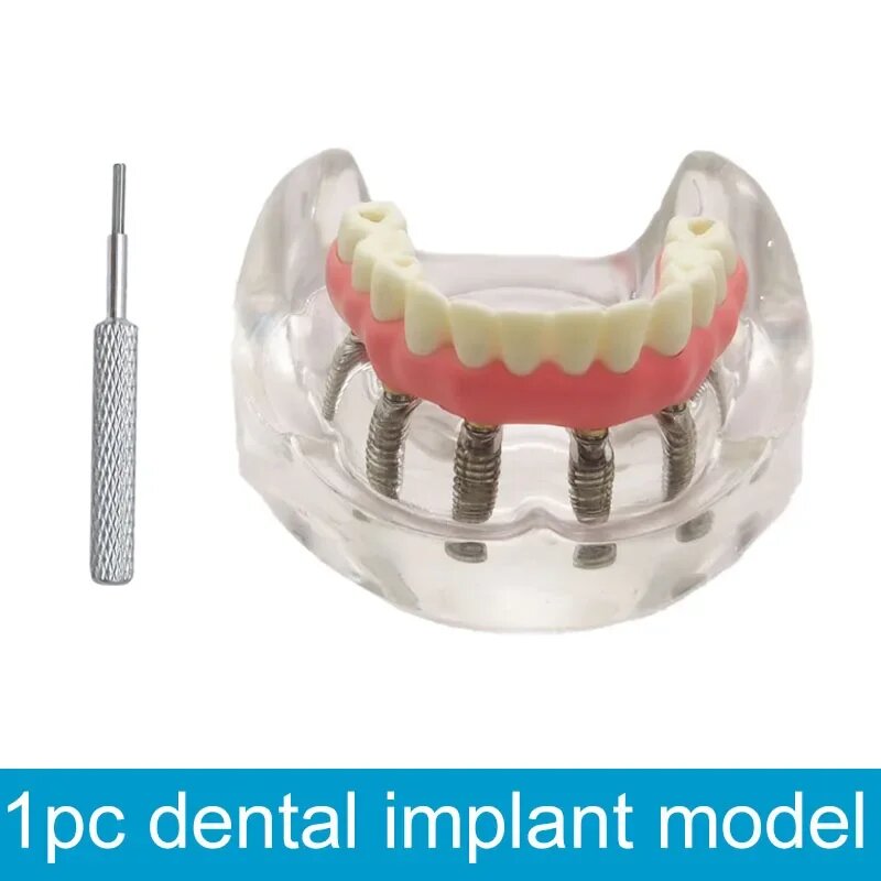 Съемная модель импланта SKATTOOTH Dental Implant Model