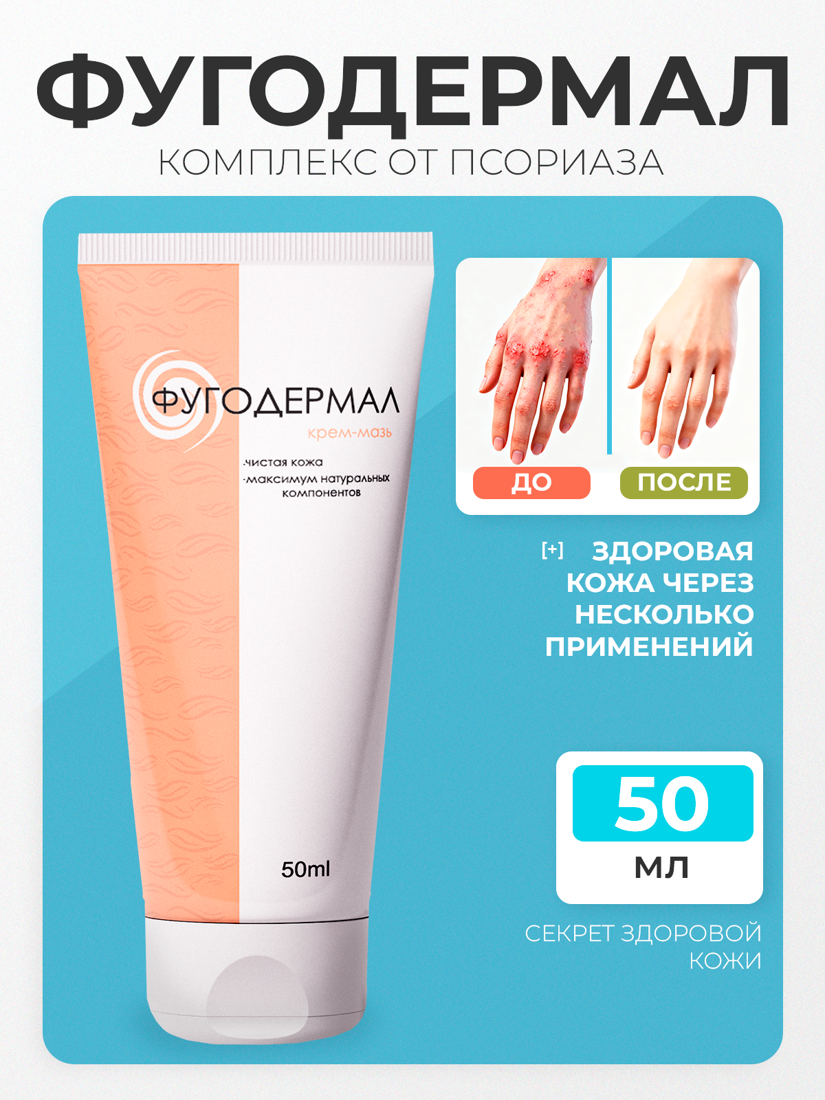 Fugodermal: крем от псориаза, средство от псориатических бляшек и зуда, натуральный состав, 50 мл — фото 1