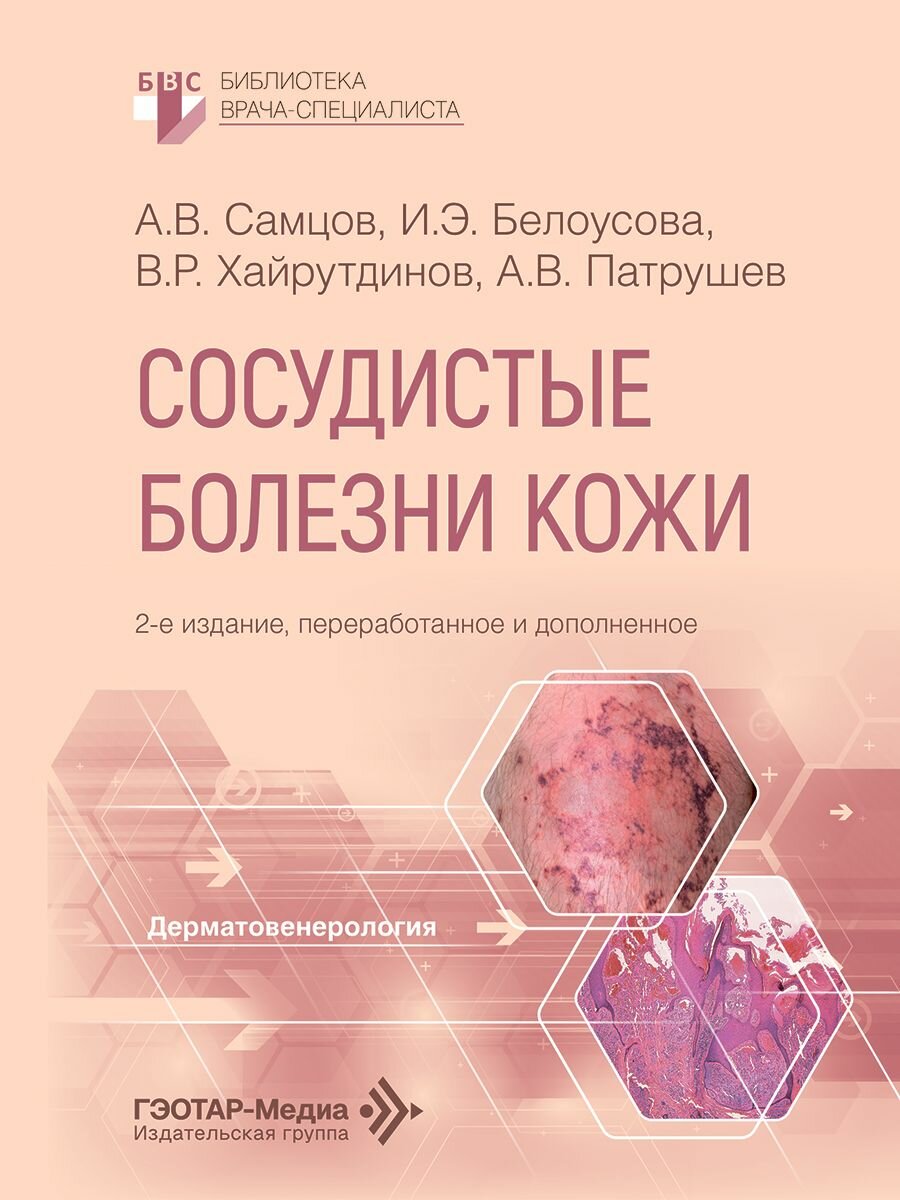 Сосудистые болезни кожи