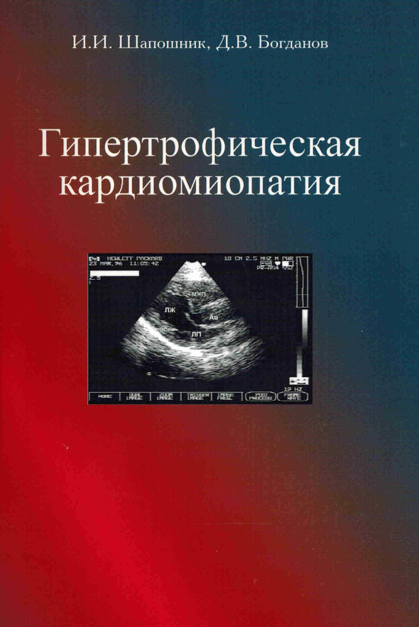 Гипертрофическая кардиомиопатия (Шапошник И. И, Богданов Д. В.)