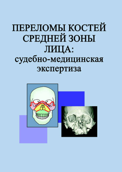 Переломы костей средней зоны лица: судебно-медицинская экспертиза [Цифровая книга]