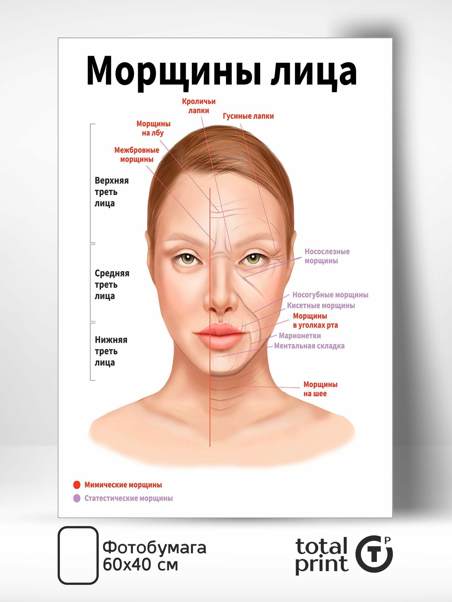 Постер на медицинскую тематику, 60х40см, Морщины лица, TotalPrint