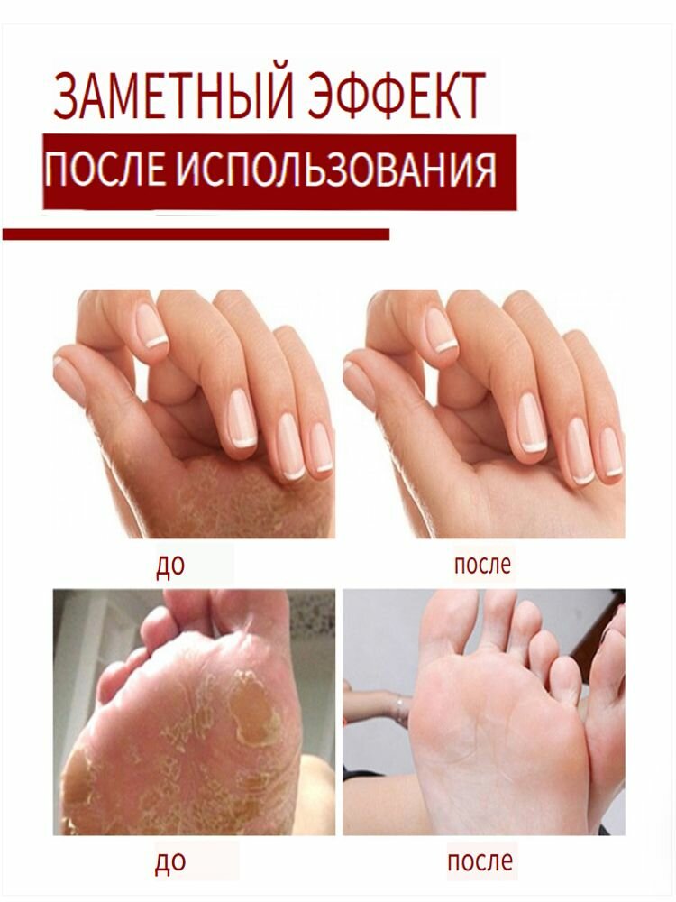 Крем Мазь от трещин для сухой кожи ног и рук, заживление, , восстанавливающий и увлажняющий для грубой рук