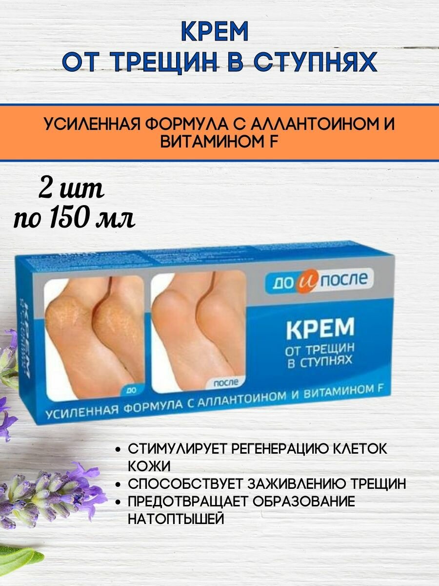 До и после Крем для ног от трещин в ступнях 2шт по 150мл