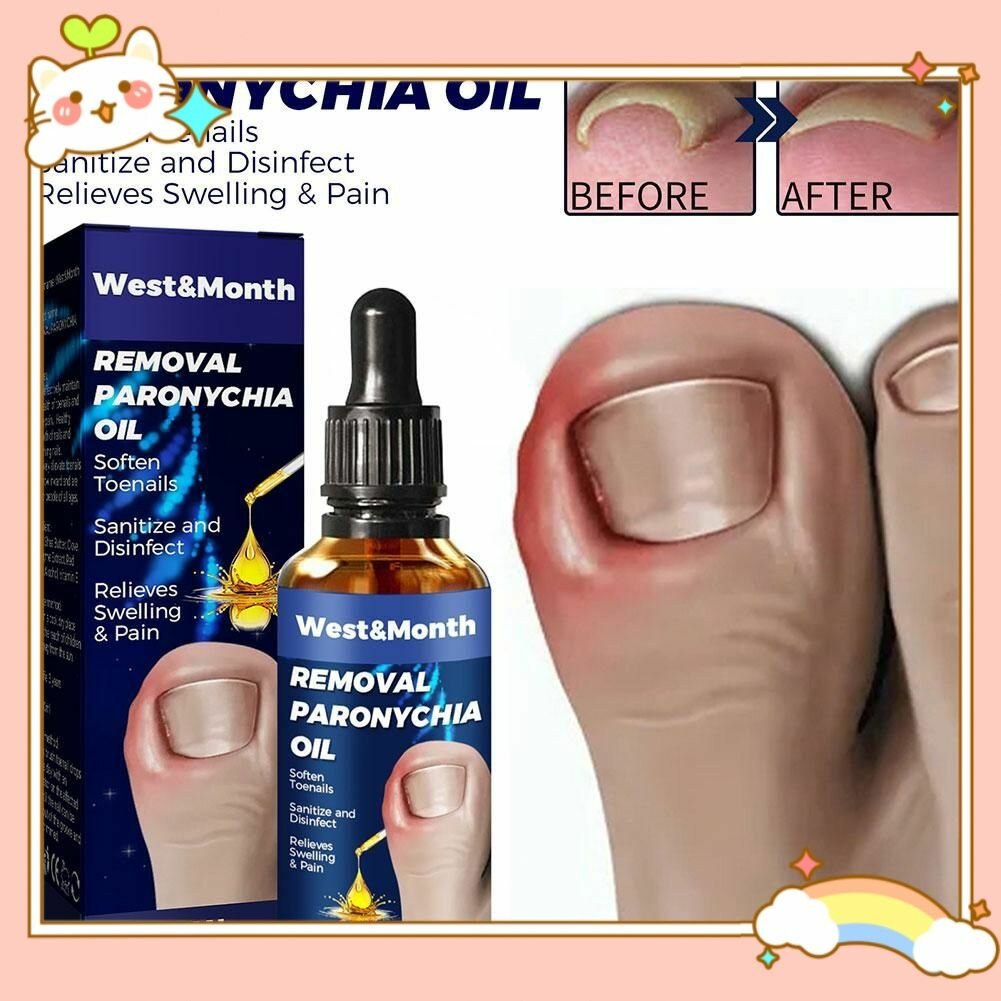 Корректор от вросшего ногтя