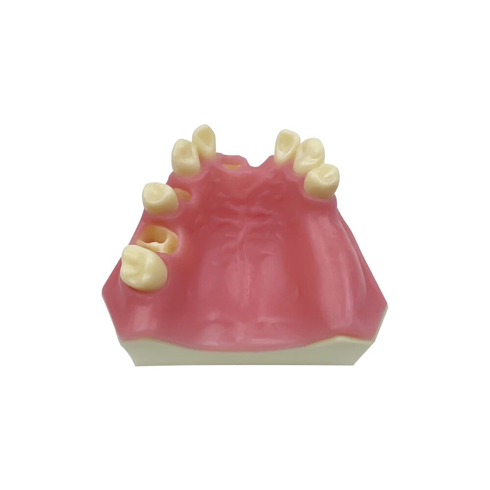 Модель имплантата YOUYA DENTAL Mandibular sinus Teeth Model implant Model