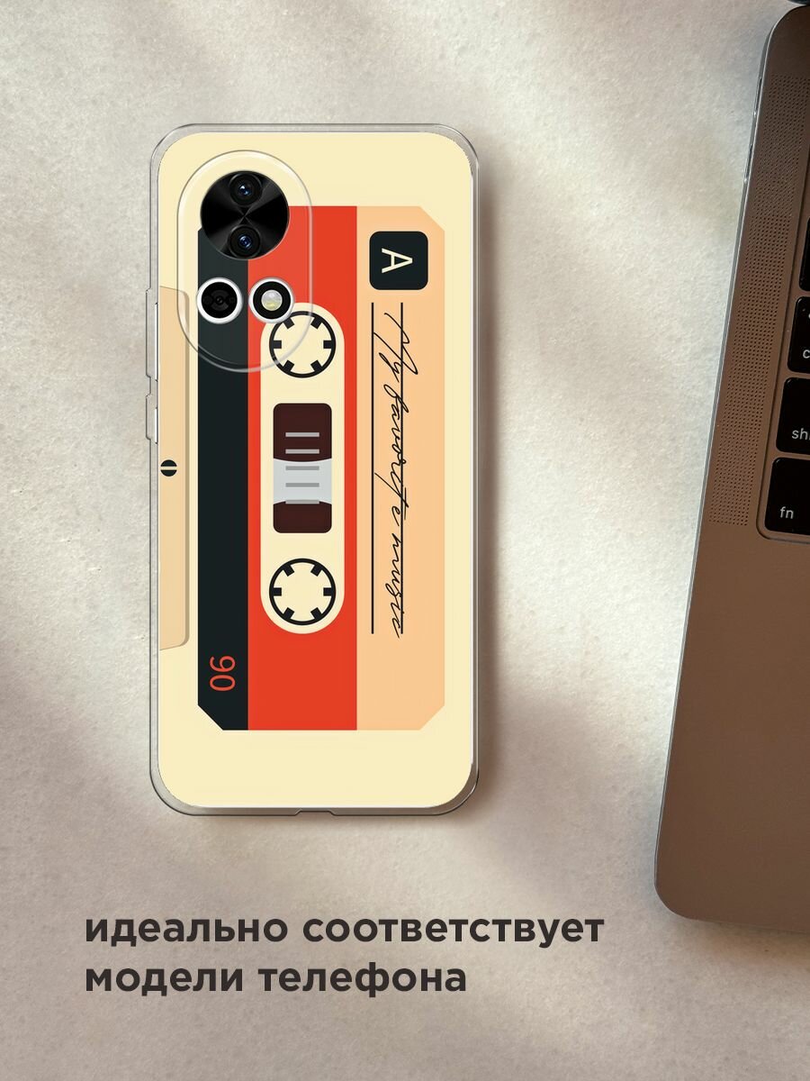Чехол на Huawei Nova 12/Nova13 / Хуавей Нова 12/Нова 13 с принтом "Бежевая кассета" — фото 1
