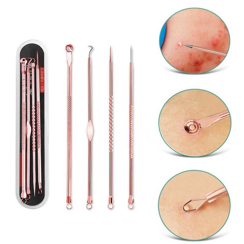 Набор для удаления угрей ONEVAN из нержавеющей стали 4 шт. Box Gold