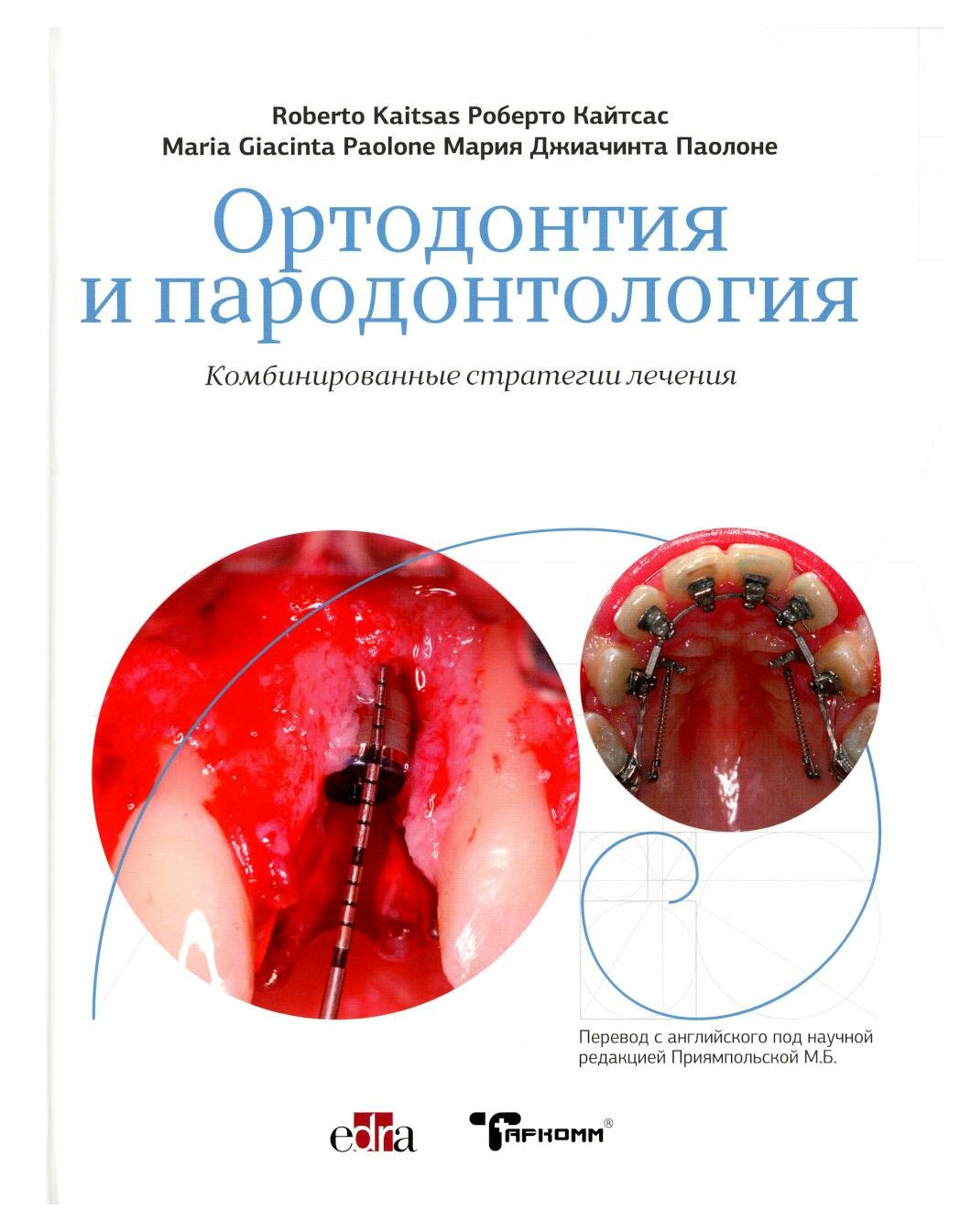 Ортодонтия и пародонтология: комбинированные стратегии лечения. Кайтсас Р, Паолоне М. Дж. Таркомм