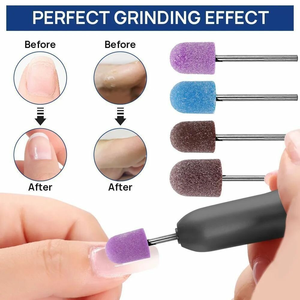 Колпачки фрезы песочные для аппаратного педикюра (маникюра) XCAN с алмазной крошкой 13 мм 240 грит, набор 5 штук + насадка