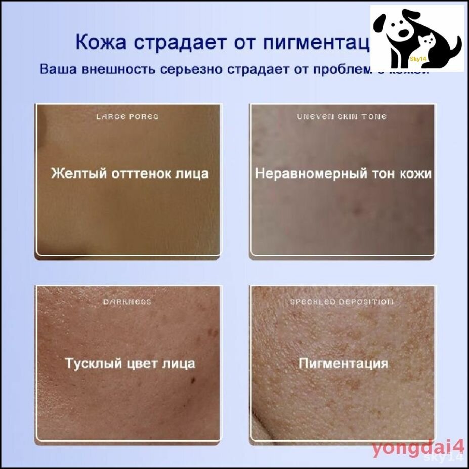 Эксклюзивный крем 30 мл для осветления кожи, эффективно устраняющий пигментные пятна и веснушки на лице