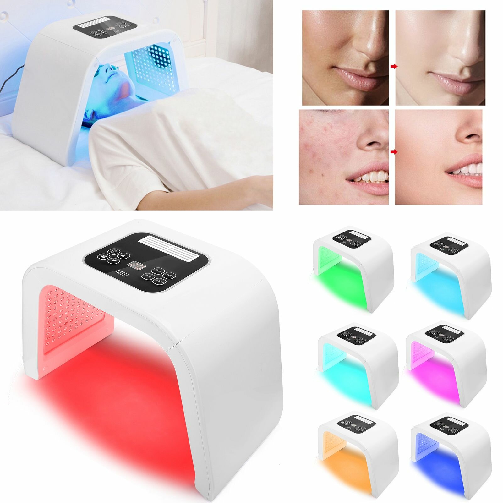 Многофункциональная Фотонная Машина, LED Светотерапия, Для Омолаживания и Восстановления Кожи 100-240 В/Европейский стандарт