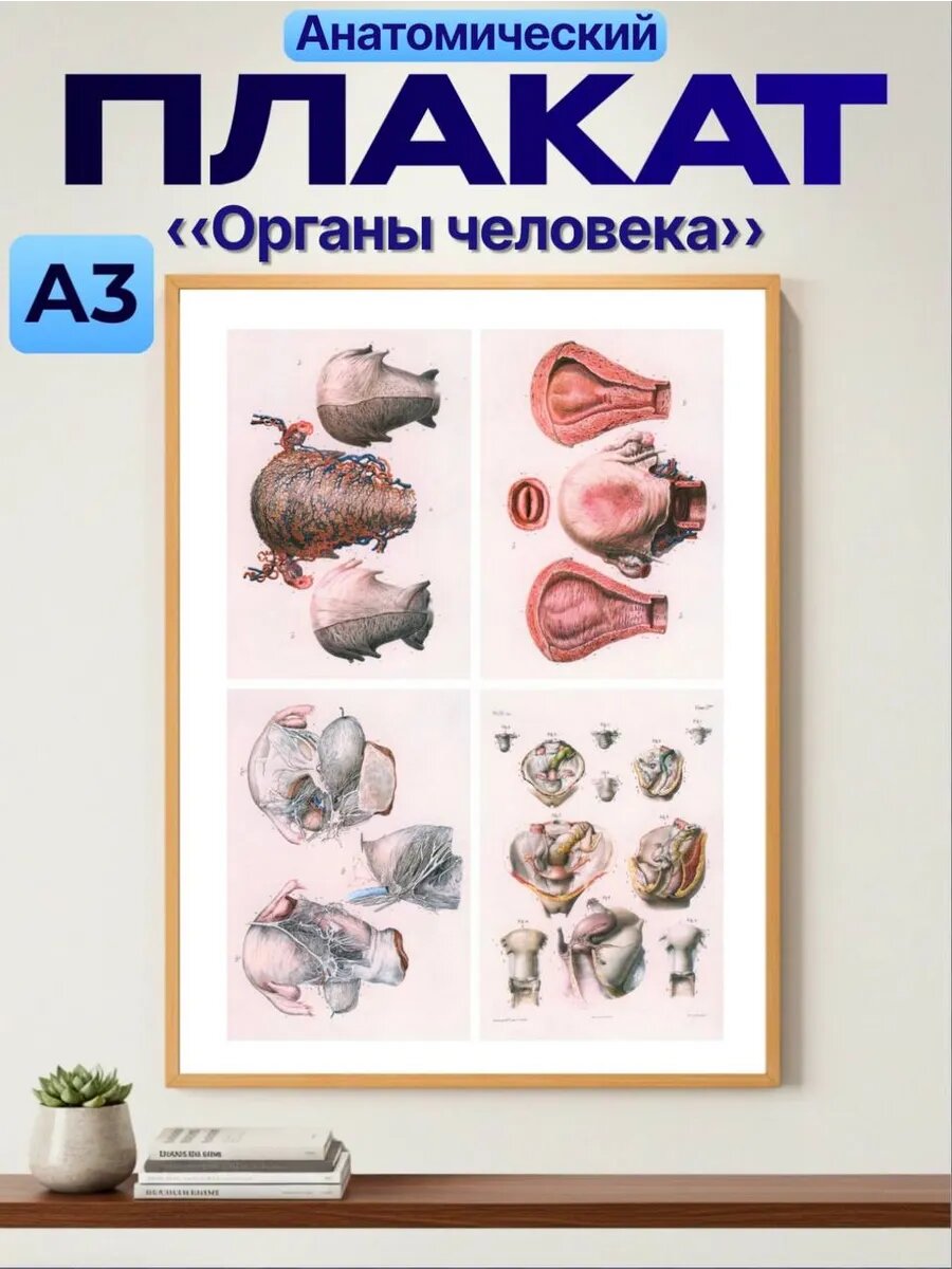 Постер медицинский, матка, органы человека, А3 анатомия, хирургия