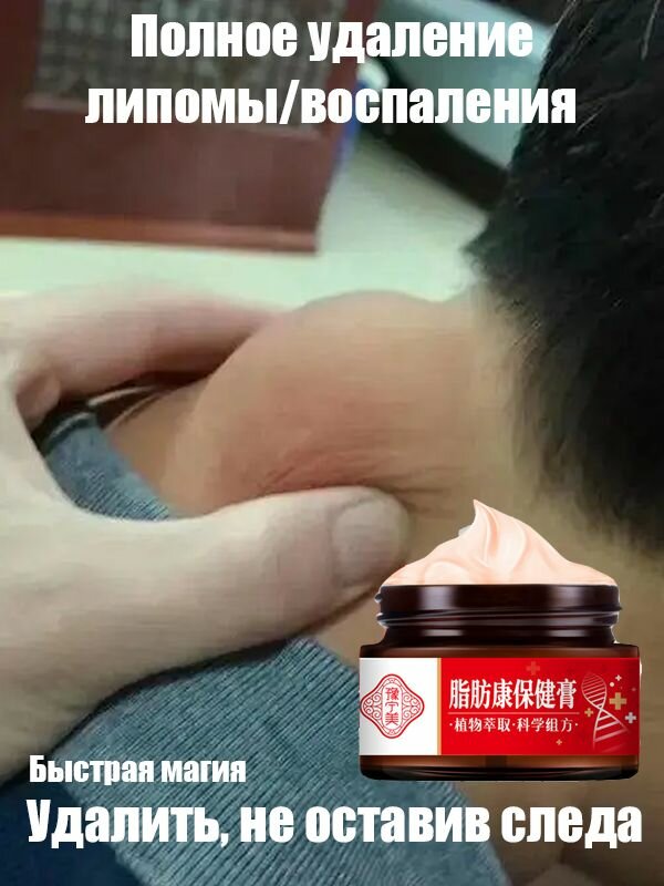 Жирный крем устраняет шишки и липомы по всему телу, быстро устраняет подкожные отеки и фиброз, 30 граммов натурального китайского лекарства.