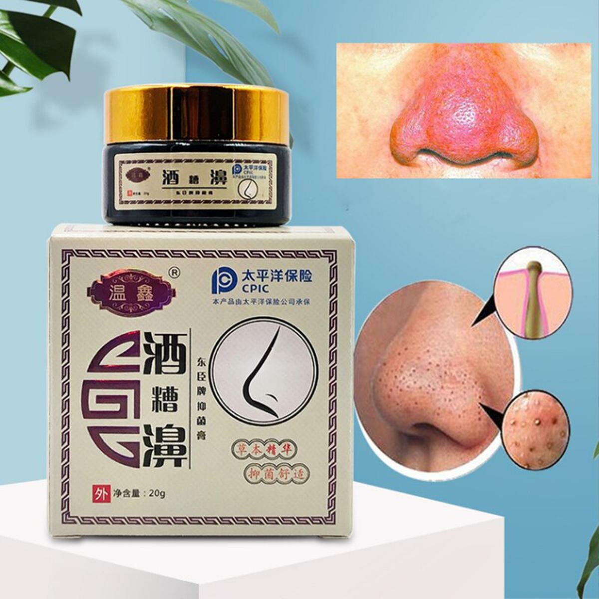 Крем от розацеи, мазь от красного носа, крем от прыщей, средство от угрей и клещей, средство от акне, сужение пор