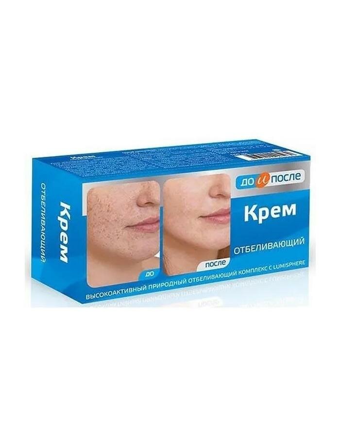 До и после, крем отбеливающий, 100 мл, 1 шт.